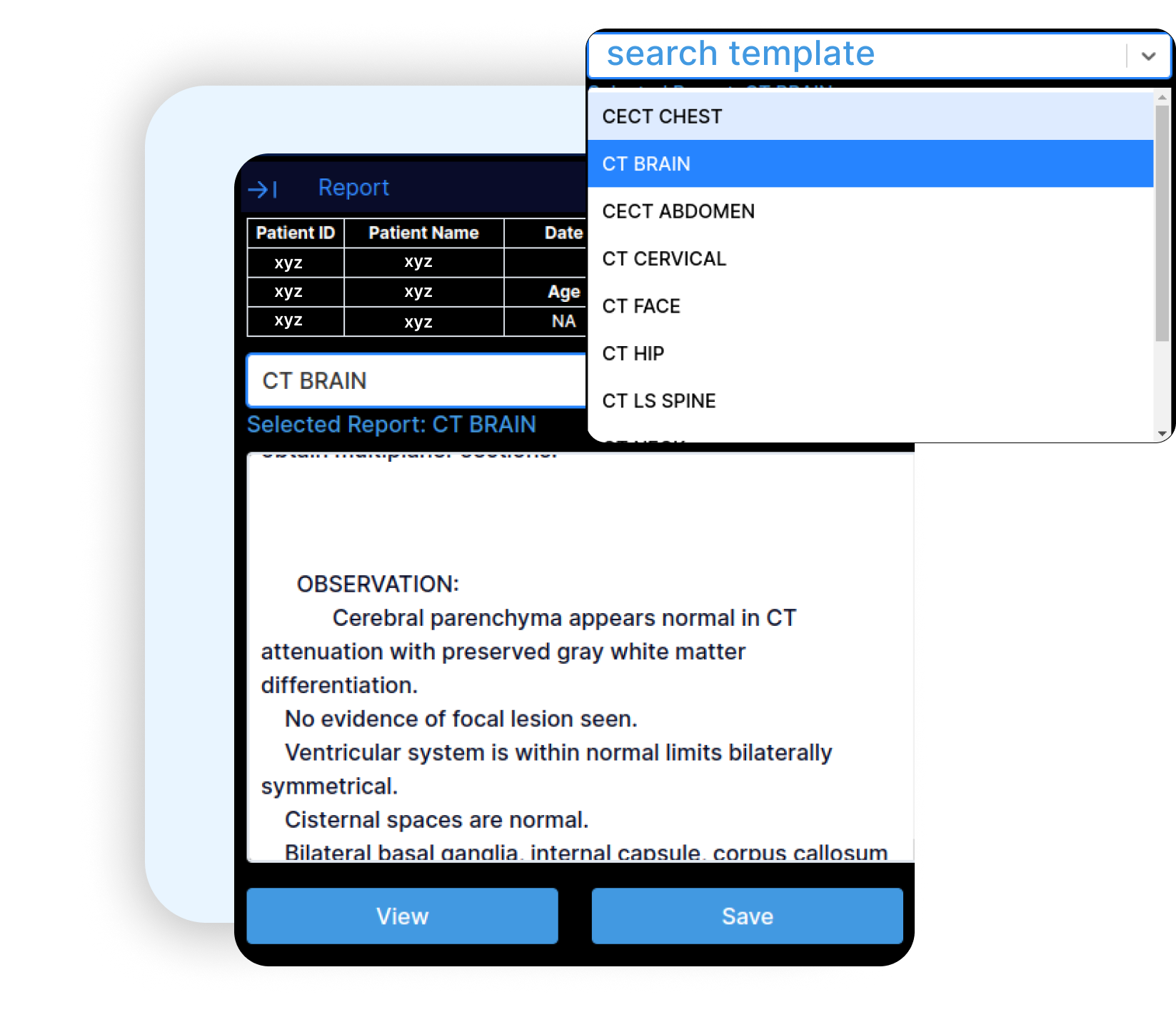 AI-Powered Teleradiology Software | Supravi.ai